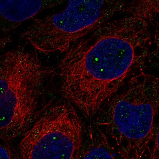 Anti-CLUH antibody (ab222075) | Abcam