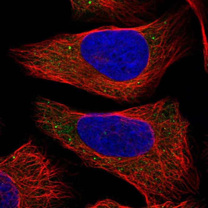 Anti-COL22A1 antibody (ab121846) | Abcam