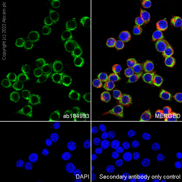 Anti-COL3A1 antibody [EPR17673] (ab184993) | Abcam