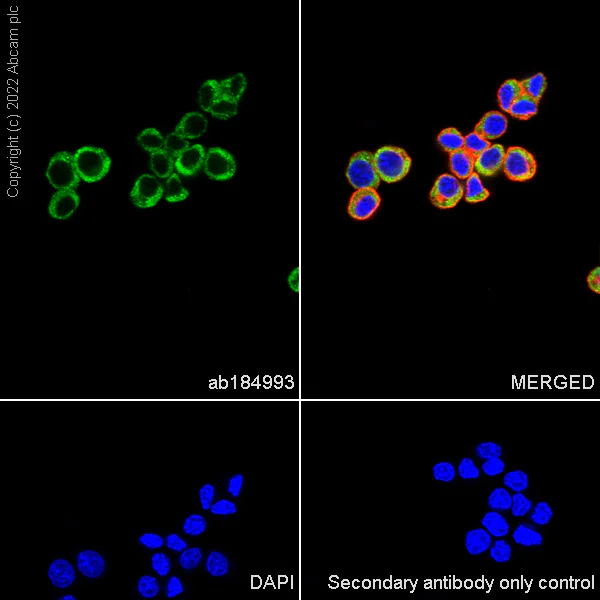 Anti-COL3A1 antibody [EPR17673] (ab184993) | Abcam