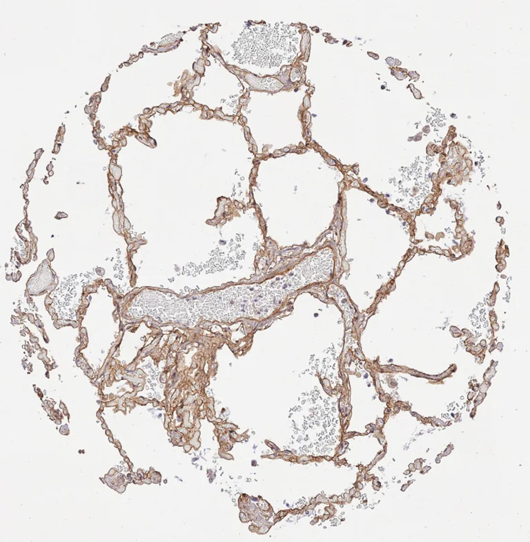 Anti-collagen IV antibody - rabbit polyclonal (ab6586) | Abcam