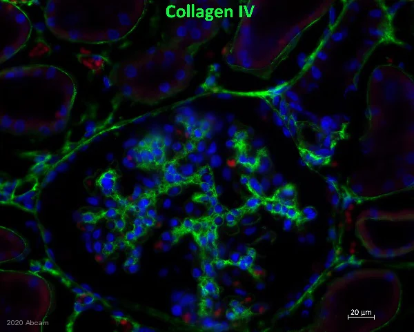 Anti-collagen IV antibody - rabbit polyclonal (ab6586) | Abcam