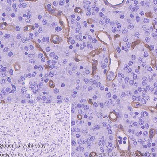 Collagen IV抗体[EPR22911-127] (ab236640)| Abcam中文官网