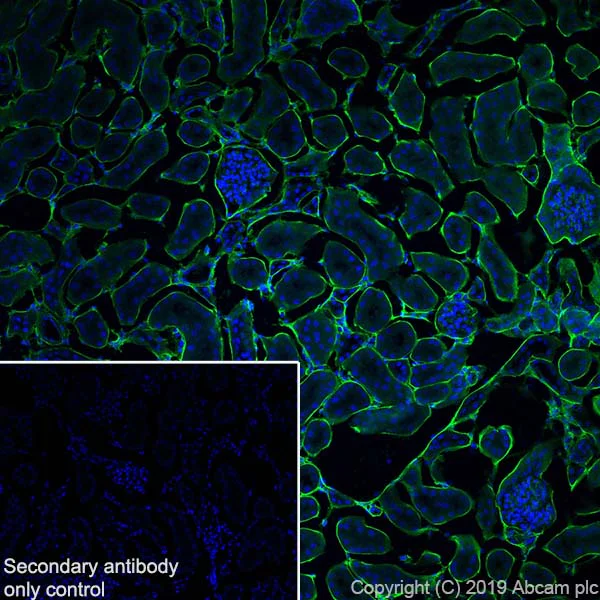 Anti-Collagen IV antibody [EPR22911-127] (ab236640) | Abcam