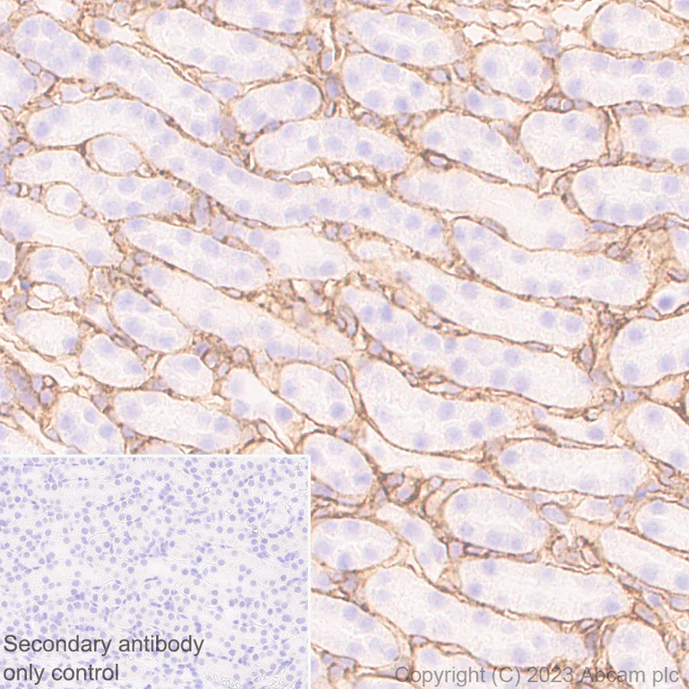 Anti-Collagen IV antibody [RM1065] (ab315250) | Abcam