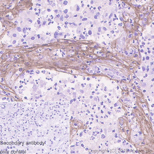 Anti-Collagen VI alpha 2 antibody [EPR7889(N)] (ab180855) | Abcam