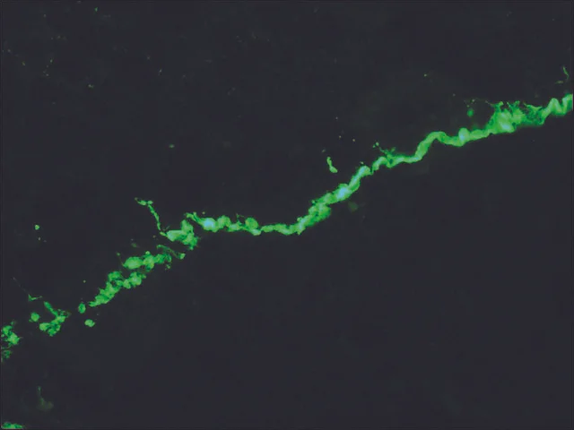 Collagen VII抗体[LH7.2] (ab6312)| Abcam中文官网