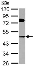 Anti-COLQ antibody (ab127048) | Abcam