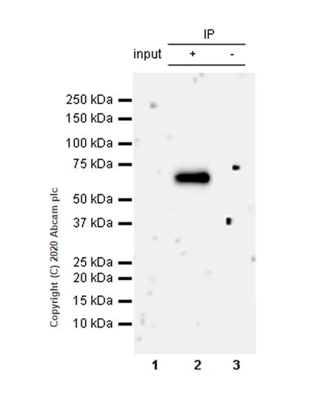 Anti-Complement factor 8 beta/C8B antibody [EPR23764-1] - BSA and Azide free (ab278049) | Abcam