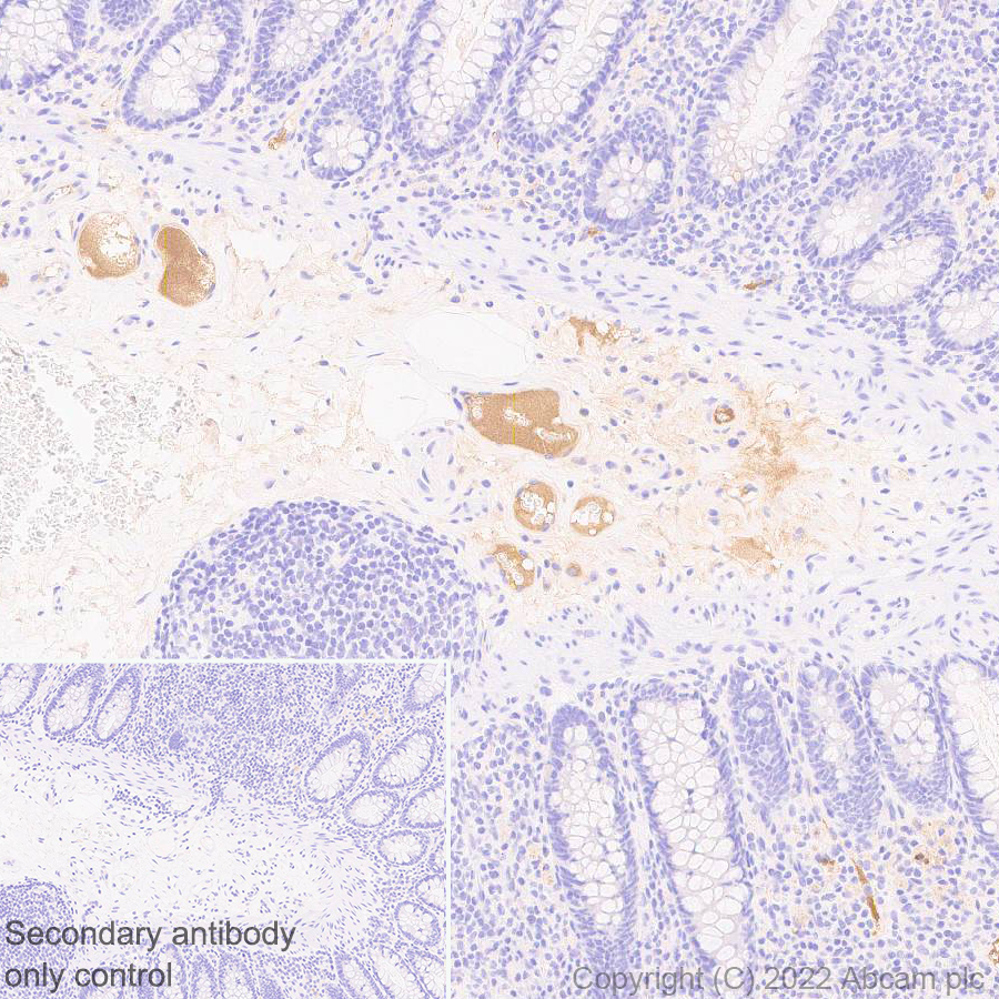 Anti-Complement factor B antibody [EPR27443-6] (ab309149) | Abcam