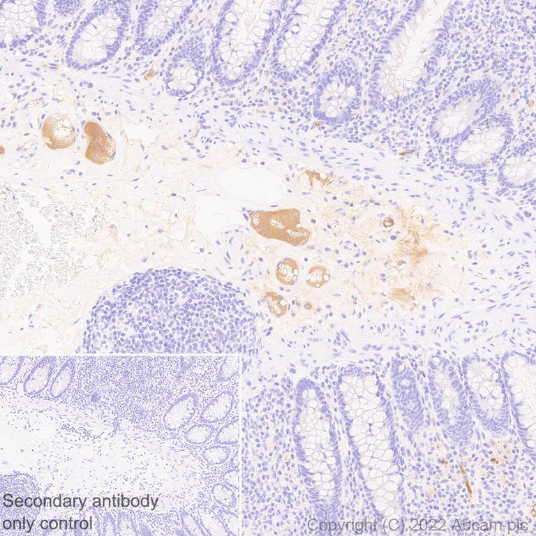 Anti-Complement factor B antibody [EPR27443-6] (ab309149) | Abcam
