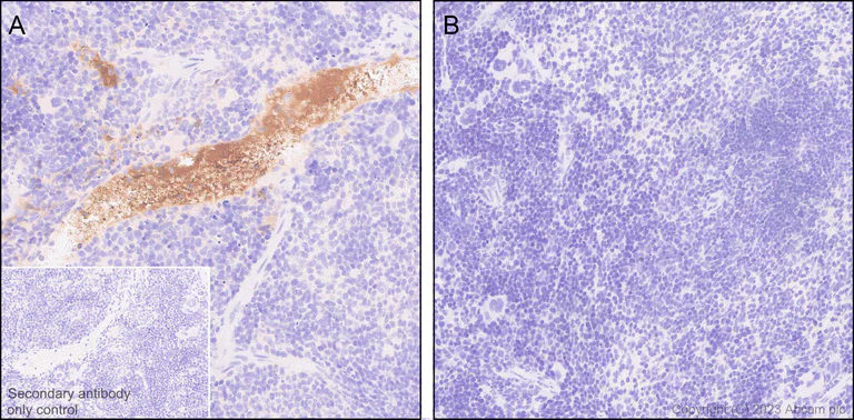 Anti-Complement factor B antibody [EPR27443-6] (ab309149) | Abcam