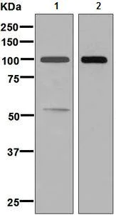 Anti-Complement factor B antibody [EPR9288(B)] (ab133765) | Abcam