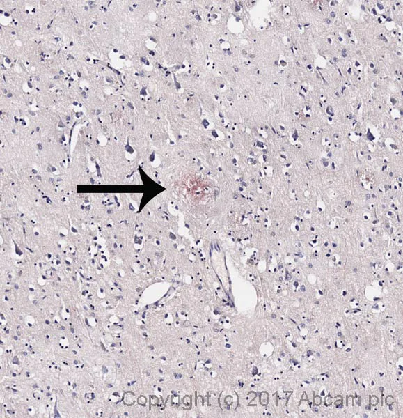 Congo Red Stain Kit (Amyloid Stain) (ab150663) | Abcam