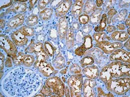 Anti-Connexin 32 / GJB1 antibody [EPR8036(2)] - BSA and Azide free ...