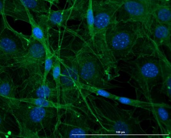 Anti-Connexin 43 / GJA1 antibody [Connexin 43] - Intercellular Junction ...