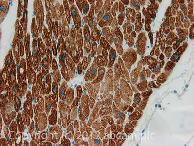 COP1抗体[1E4] (ab56400)| Abcam中文官网