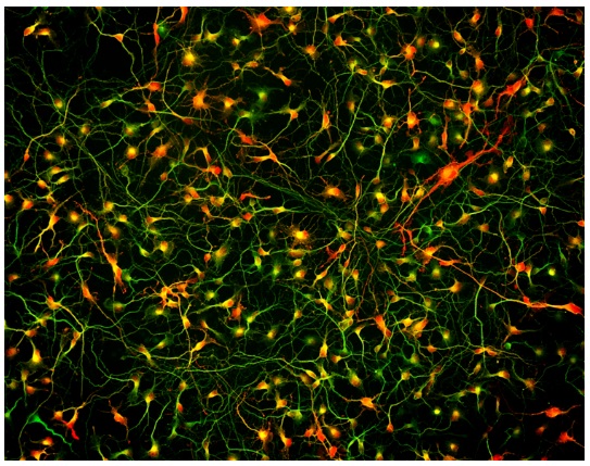 Cortical GABAergic Neurons - Human iPSC-derived cells (Male, WC-30 ...