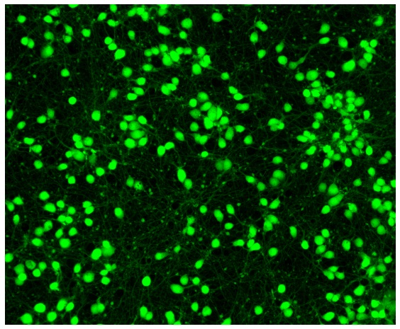 Cortical Glutamatergic Neurons - Human iPSC derived cells (GFP ...