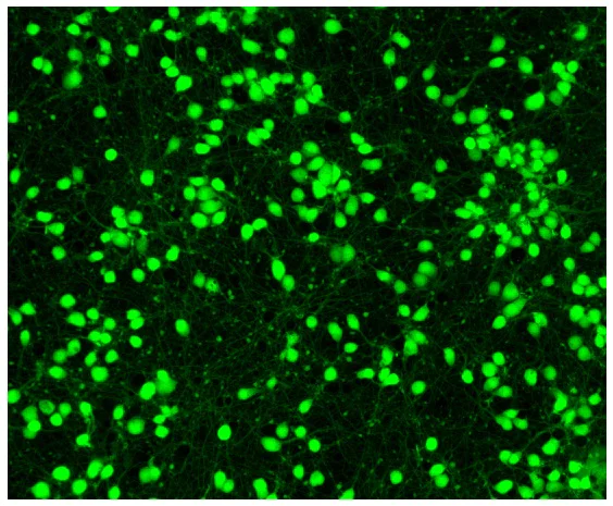 Cortical Glutamatergic Neurons - Human iPSC derived cells (GFP ...