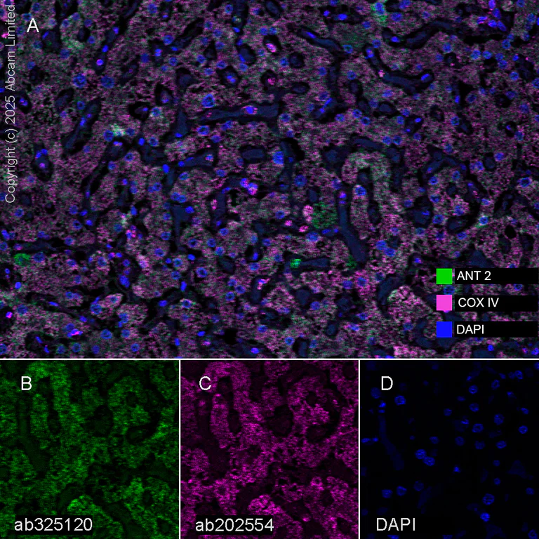 COX IV抗体[EPR9442(ABC)] - Mitochondrial Loading Control (ab202554 ...