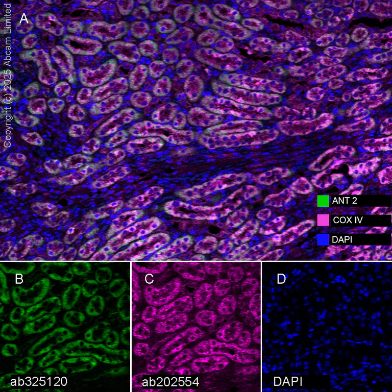 COX IV抗体[EPR9442(ABC)] - Mitochondrial Loading Control (ab202554 ...
