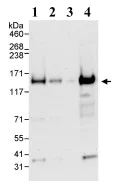 Anti-CP110 antibody (ab99338) | Abcam