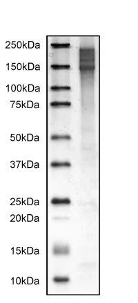 Anti-CPS1 antibody [2E4AE11] (ab110303) | Abcam