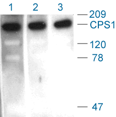 Anti-CPS1 antibody (ab3682) | Abcam