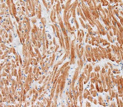 Anti-CPT1B antibody (ab134988) | Abcam