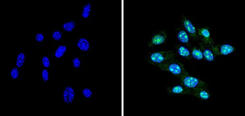 CREBBP抗体 (ab2832)| Abcam中文官网