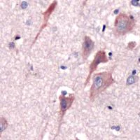 Anti-CRF antibody - C-terminal (ab231443) | Abcam