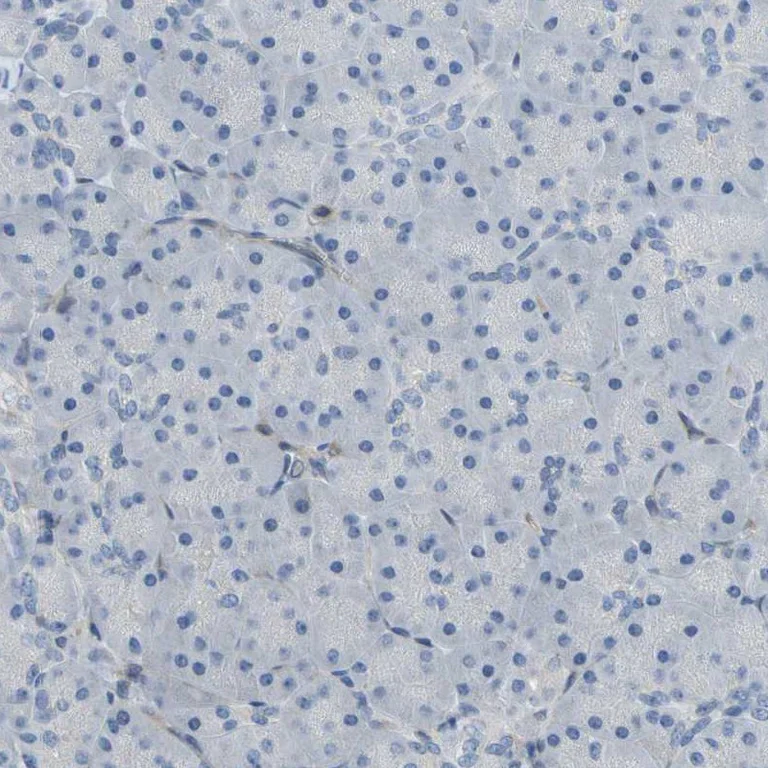 Anti-CRTAC1 antibody (ab254691) | Abcam