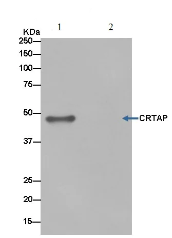 CRTAP/CASP抗体[EPR15122(B)] (ab183720)| Abcam中文官网