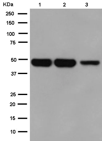 CRTAP/CASP抗体[EPR15122(B)] (ab183720)| Abcam中文官网