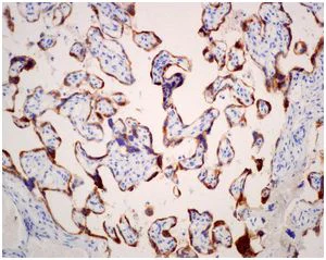 Anti-CSHL1/CSL antibody [EPR12580] (ab174295) | Abcam
