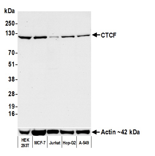 Anti-CTCF antibody [BLR041F] (ab243897) | Abcam