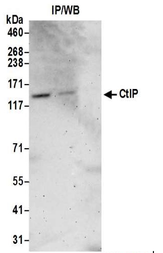 Anti-CtIP antibody (ab70163) | Abcam