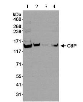 Anti-CtIP antibody (ab70163) | Abcam