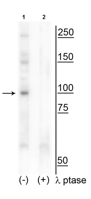 Anti-CtIP (phospho T847) antibody (ab254068) | Abcam