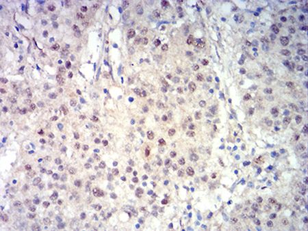Anti-CTIP2 antibody [25B6] (ab18465) | Abcam
