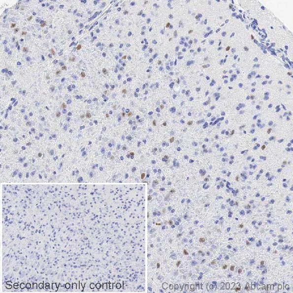Anti-CTIP2 antibody [25B6] (ab18465) | Abcam