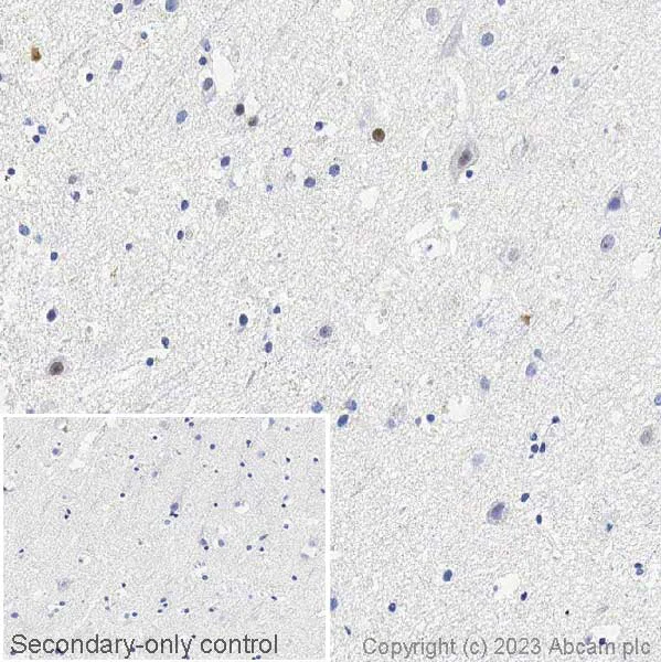 Anti-CTIP2 antibody [25B6] (ab18465) | Abcam