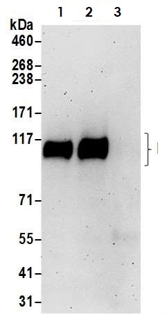 Anti-Ctip2 antibody (ab70453) | Abcam