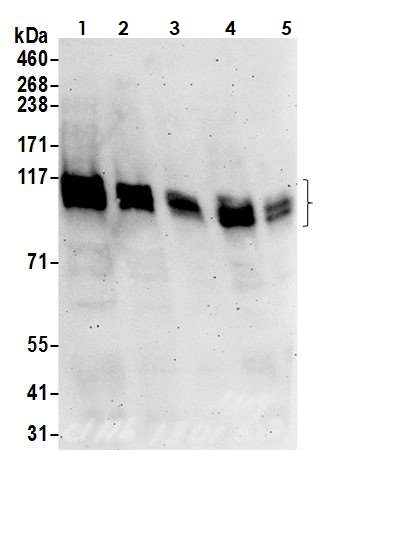 Anti-Ctip2 antibody (ab70453) | Abcam