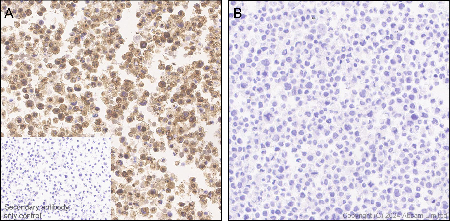 Anti-CXCL10/IP-10 antibody [RM2054] KO Tested (ab318282) | Abcam
