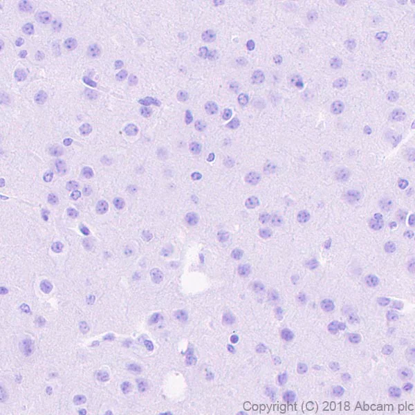 Anti-CXCL13 antibody [EPR19259-147] Rabbit monoclonal (ab199043) | Abcam