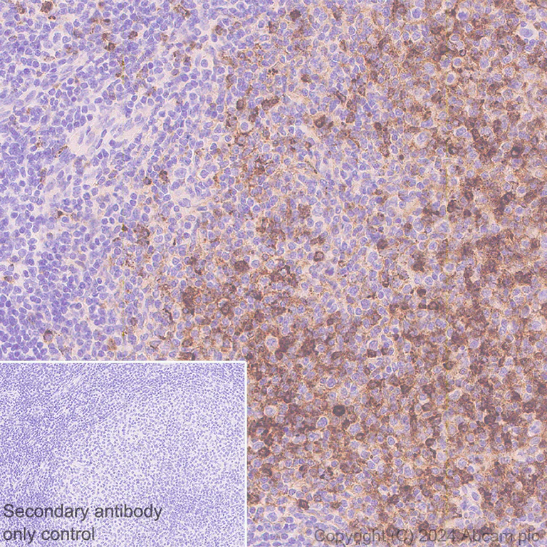 Anti-CXCL13 antibody [RM1170] (ab317508) | Abcam