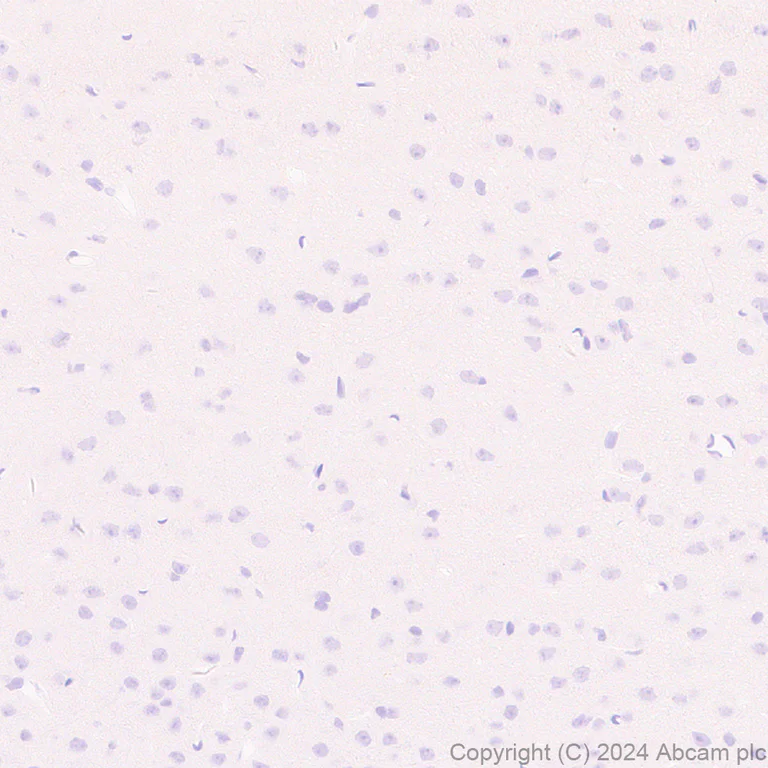 Anti-CXCL13 antibody [RM1170] (ab317508) | Abcam