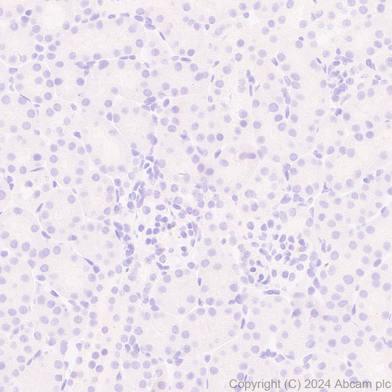 Anti-CXCL13 antibody [RM1170] (ab317508) | Abcam